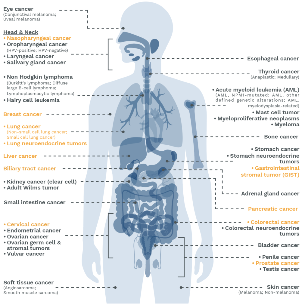 Lucence Cancer Screening | MSMC Musculoskeletal & Sports Medicine Clinic.